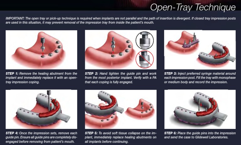 Implant Overdentures: Open-Tray Technique | PDF | Career & Growth ...