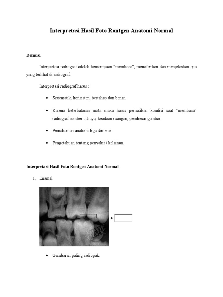Interpretasi Hasil Foto Rontgen Anatomi Normal