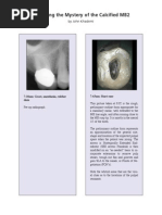 Vertucci Classification and More | PDF