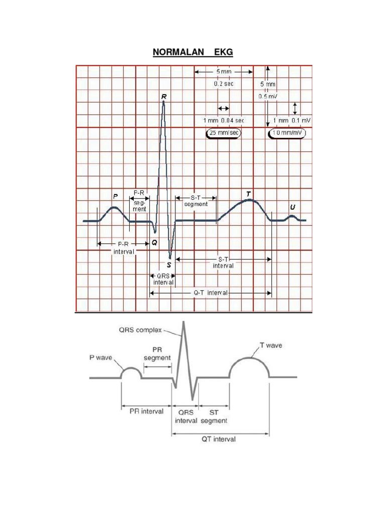 Normalan Ekg I ST Varijacije | PDF
