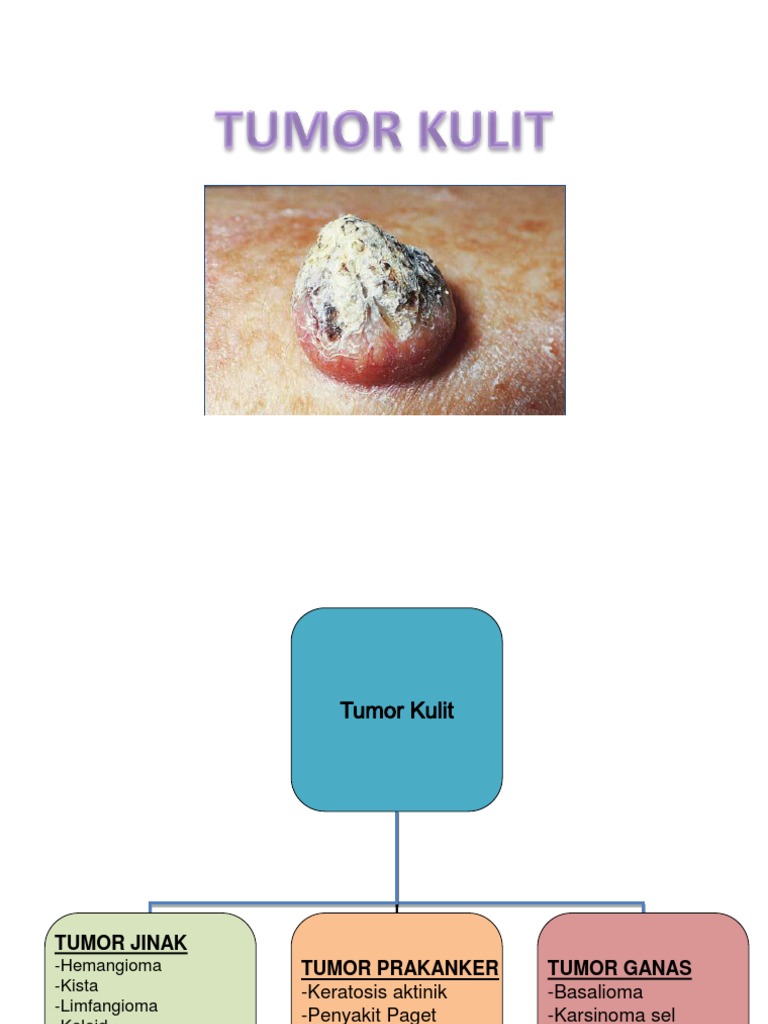 Tumor Kulit | PDF