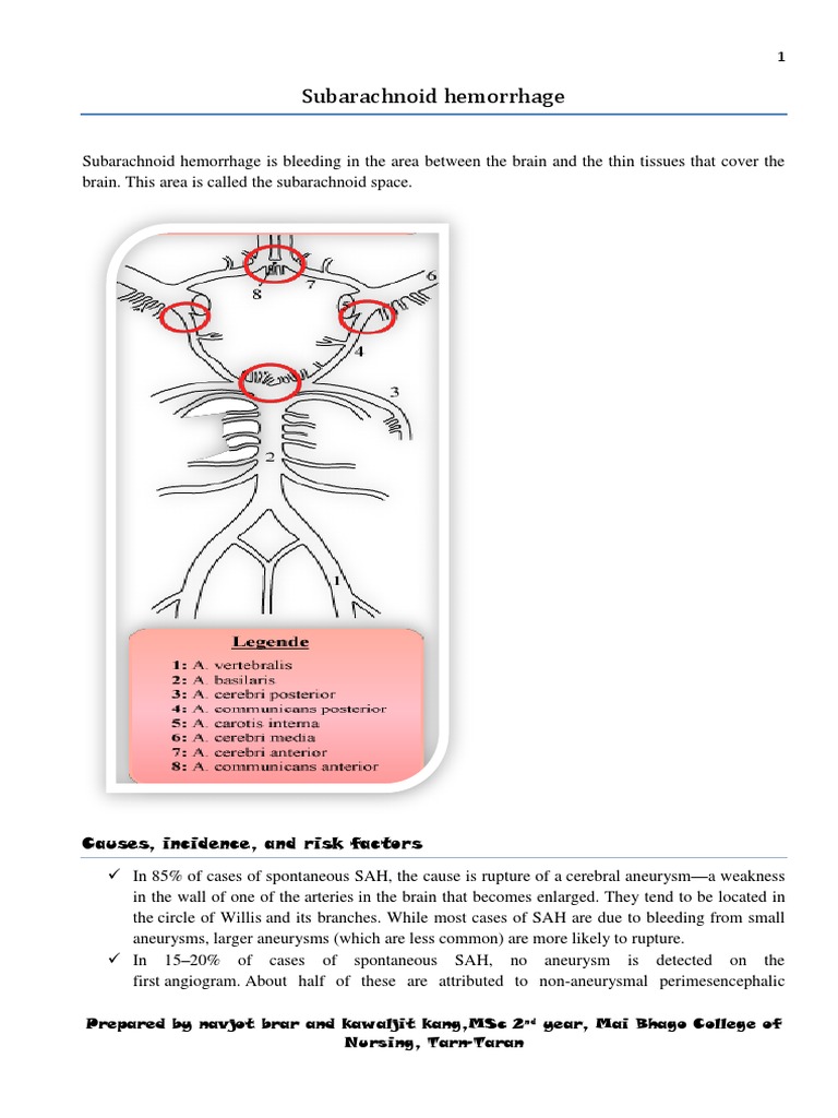 Subarachnoid Hemorrhage | Neurology | Health Sciences