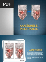 Cirugia de Hartmann | PDF | Cáncer colonrectal | Cirugía