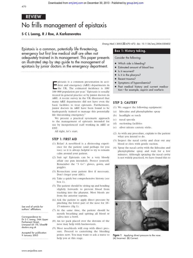A Practical Guide to Managing Epistaxis for Junior Doctors | PDF ...
