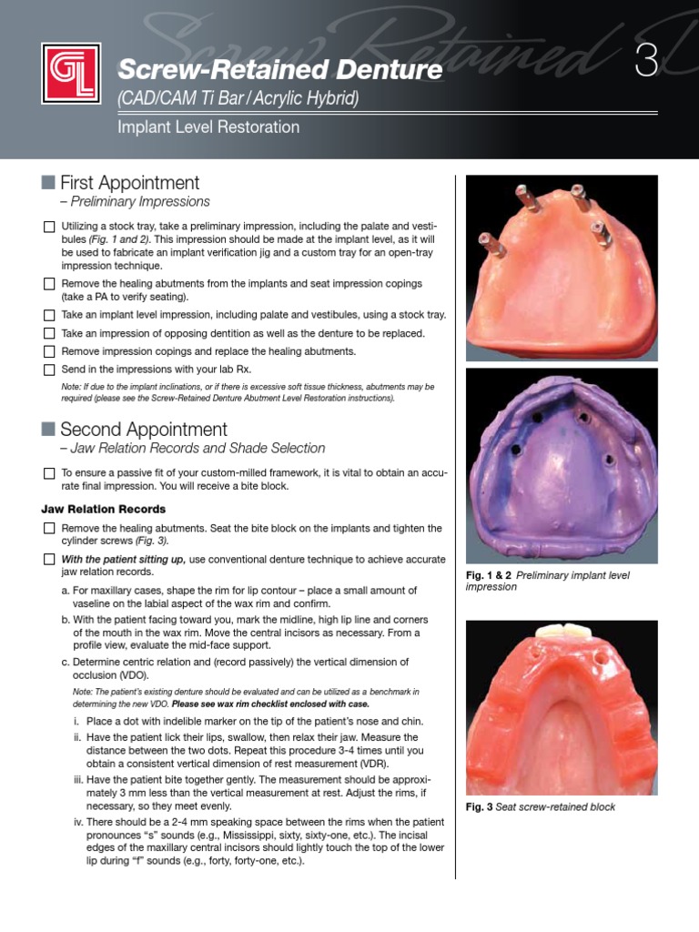 Screw Retained Implant Level | PDF | Dental Implant | Dentures