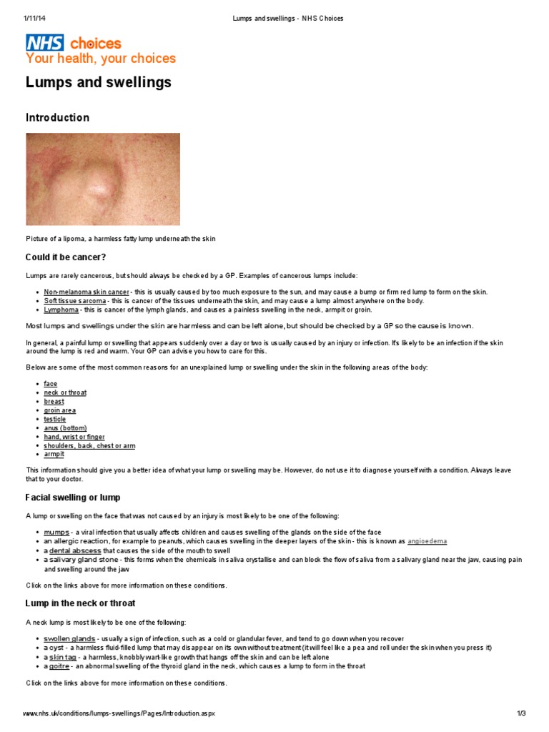Lumps and Swellings | PDF | Cancer | Anatomy