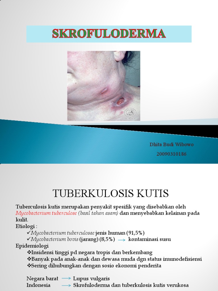 Skrofuloderma DHITA | PDF