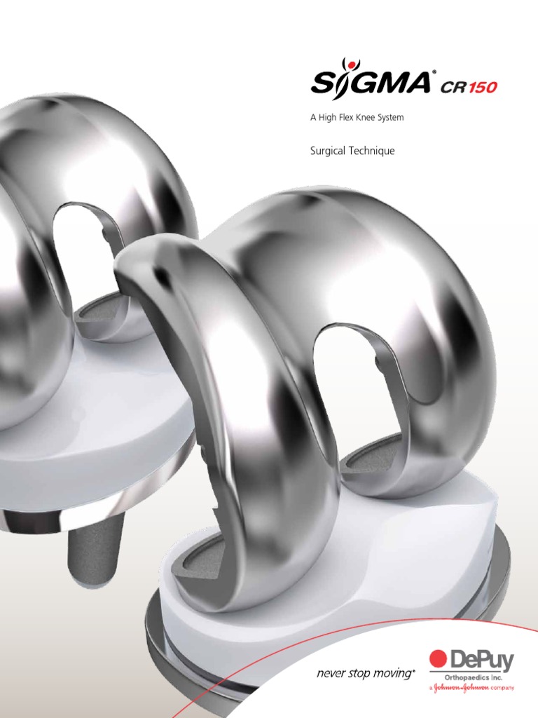 Sigma CR150 Surgical Technique | PDF | Knee | Ankle