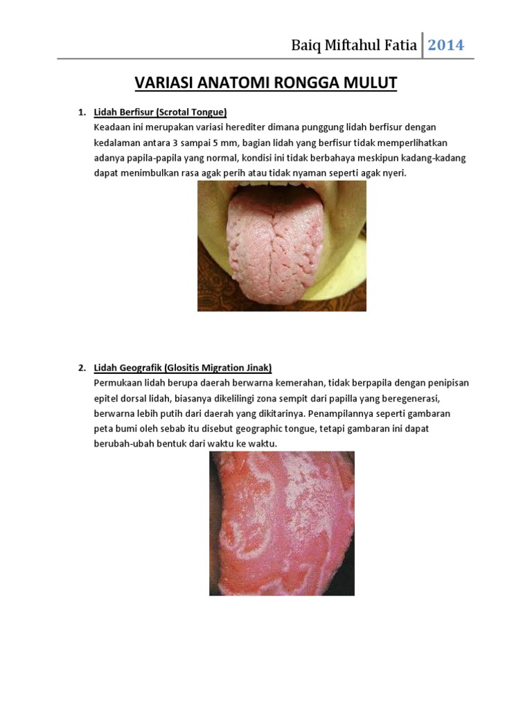 Variasi Anatomi Rongga Mulut | PDF