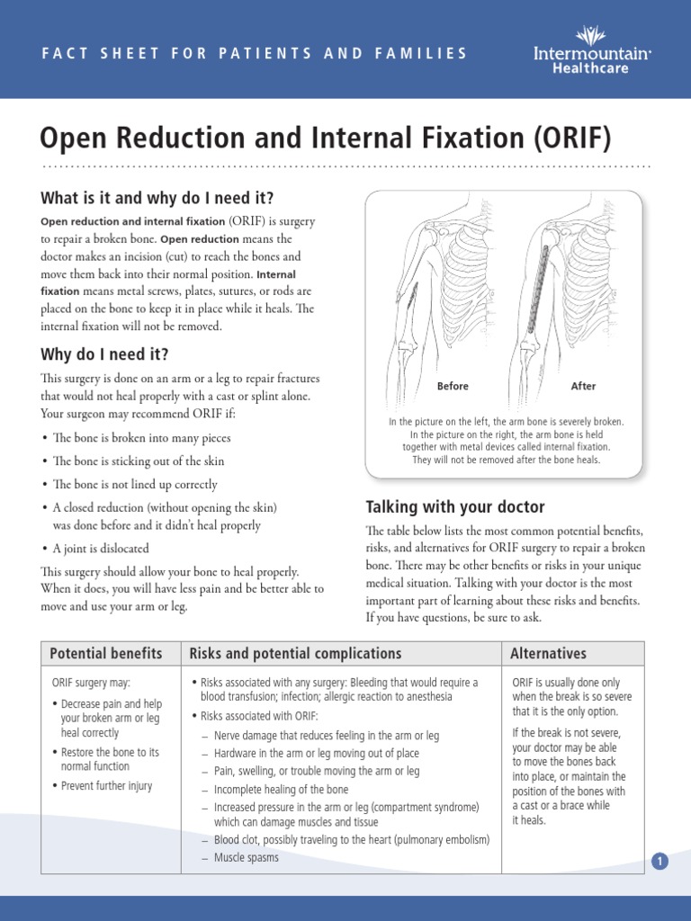 Open Reduction and Internal Fixation (Orif) : Whatisitandwhydoineedit ...