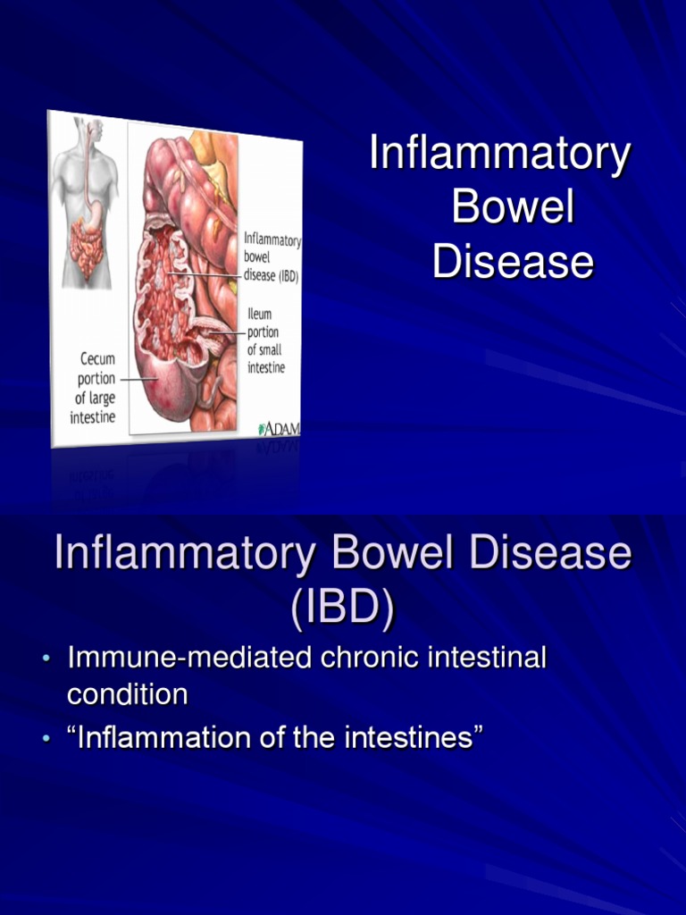 Understanding Inflammatory Bowel Disease | PDF | Inflammatory Bowel ...