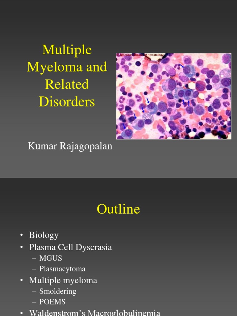 Multiple Myeloma and Related Disorders: A Guide to Plasma Cell ...