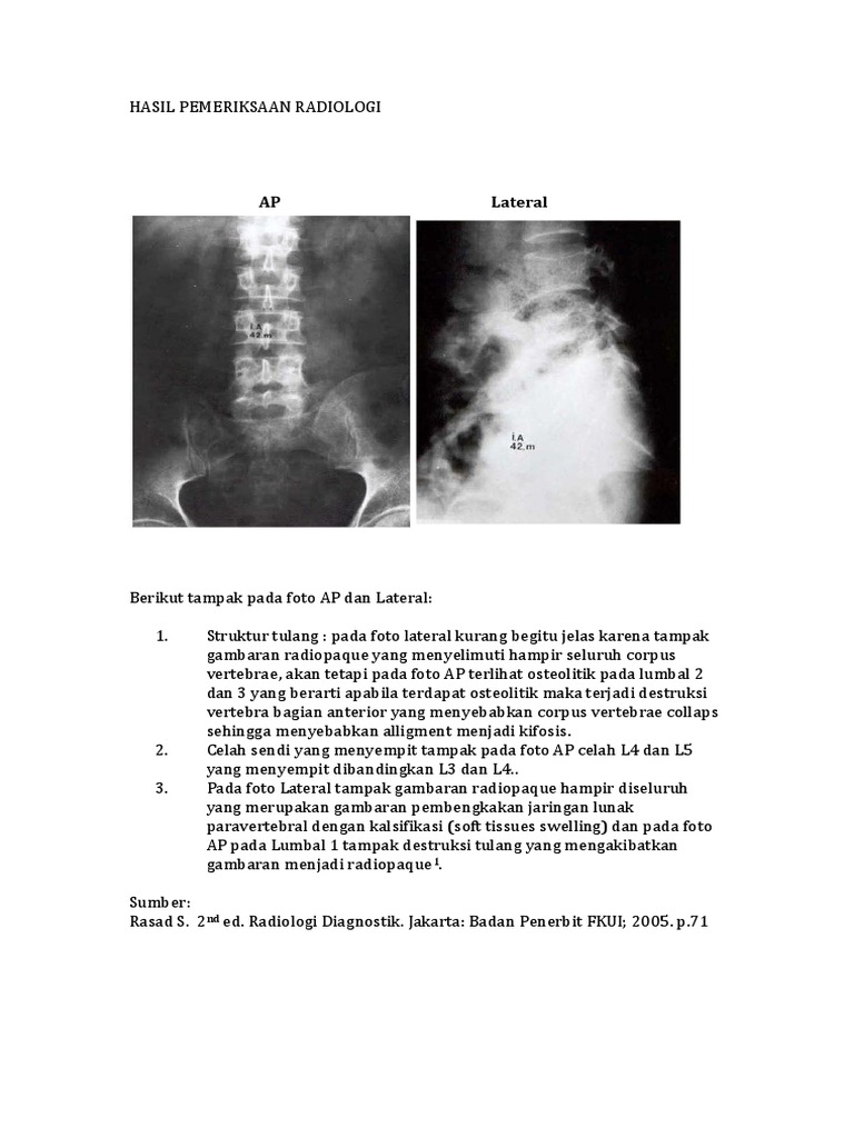 Hasil Pemeriksaan Radiologi | PDF