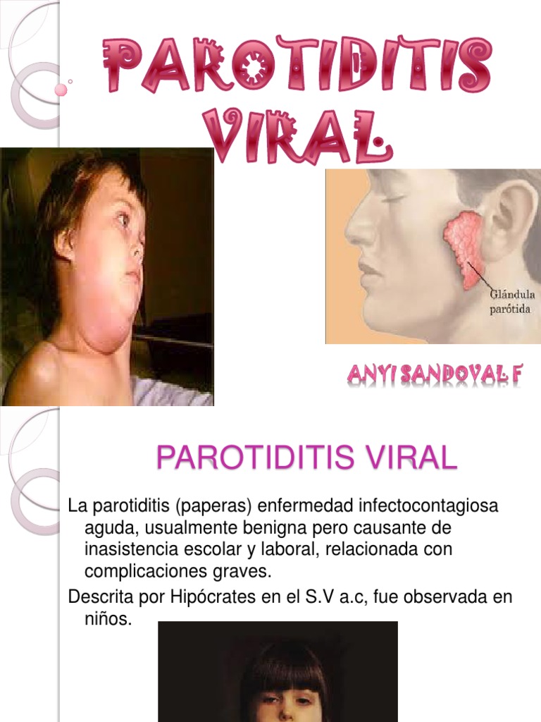 Expo Parotiditis Viral | PDF | Virus | VIH