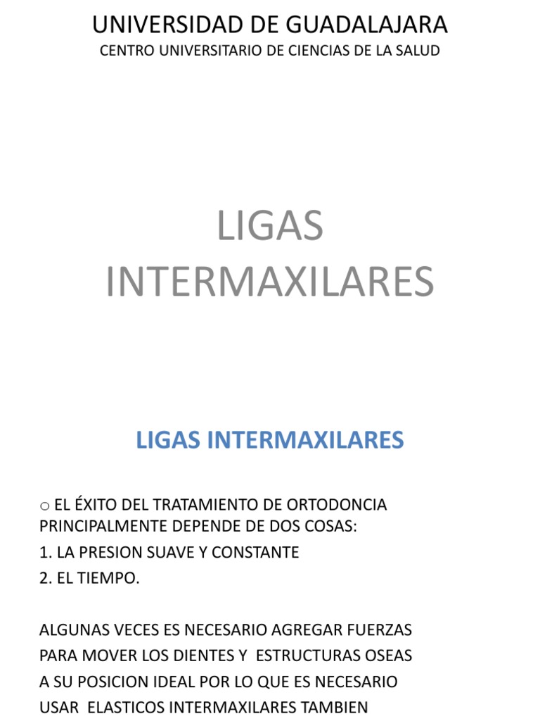 Uso de Ligas Intermaxilares en Ortodoncia | PDF