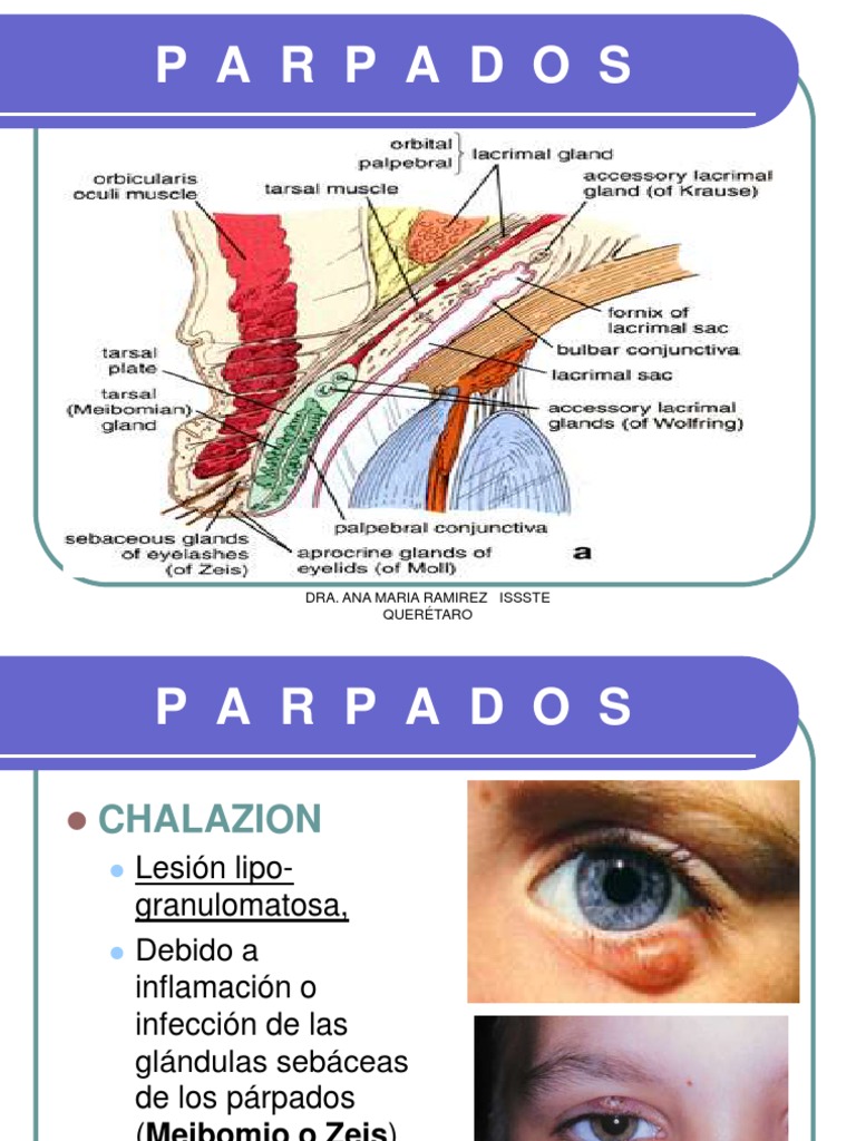 Clase Parpados PDF | Enfermedades del ojo y anexos | Oftalmología