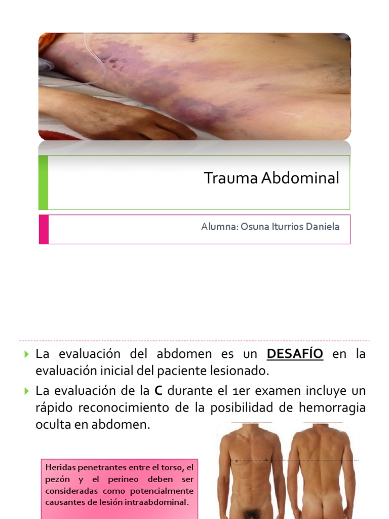 Evaluación y Manejo del Trauma Abdominal | PDF | Abdomen | Lesión