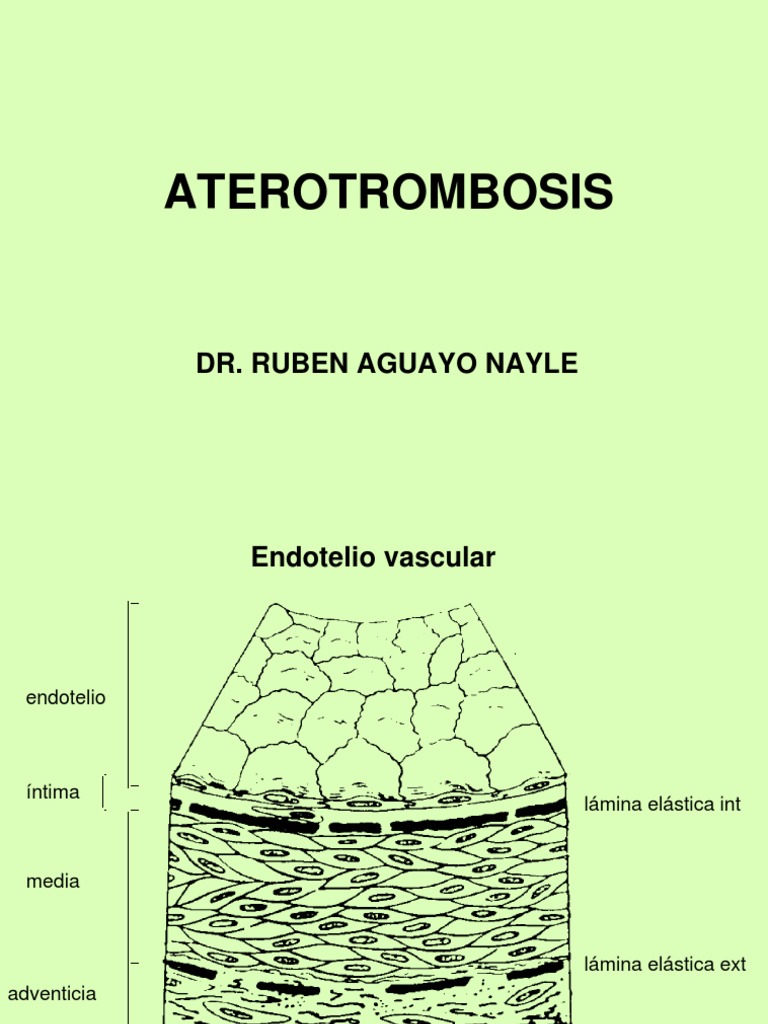 Aterotrombosis - Dr. Rubén Aguayo | PDF | Endotelio | Aterosclerosis