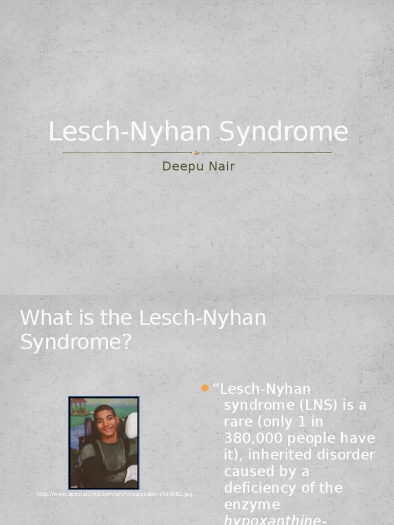 Lesch Nyhan Syndrome | Epidemiology | Medicine