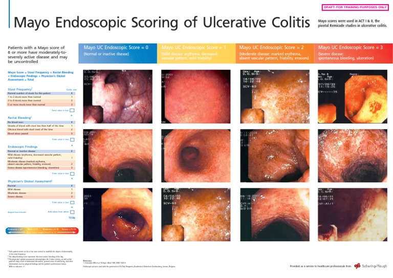 Mayo Endoscopic Scoring of Ulcerative Colitis | PDF