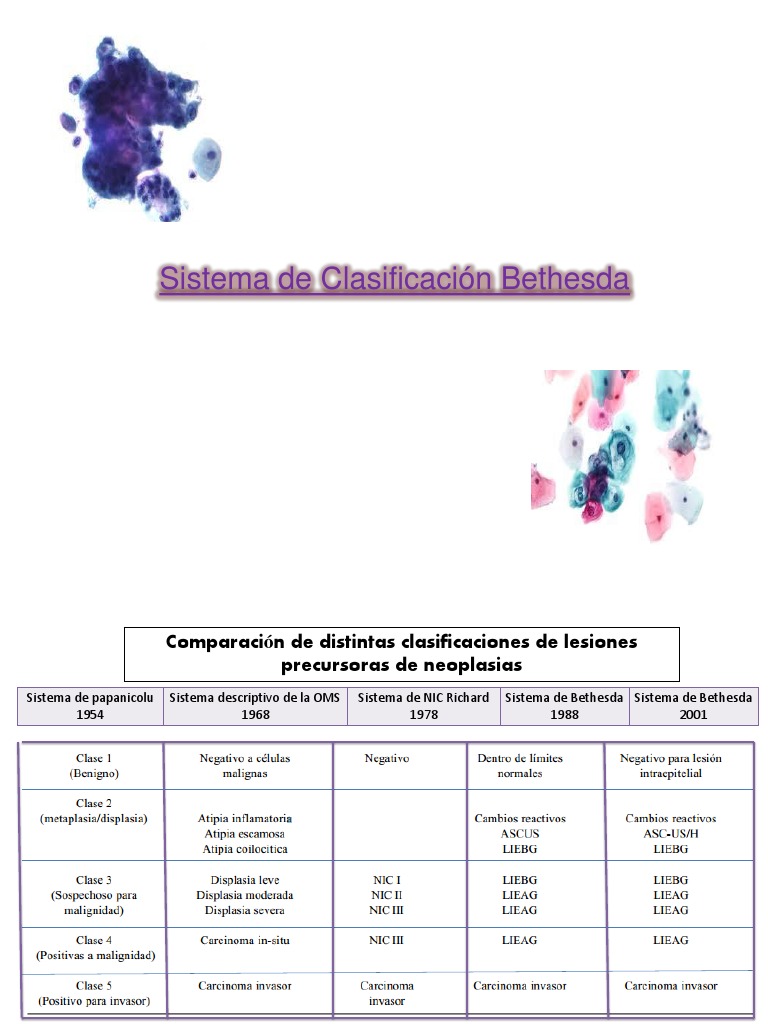 Sistema de Clasificación Bethesda | PDF