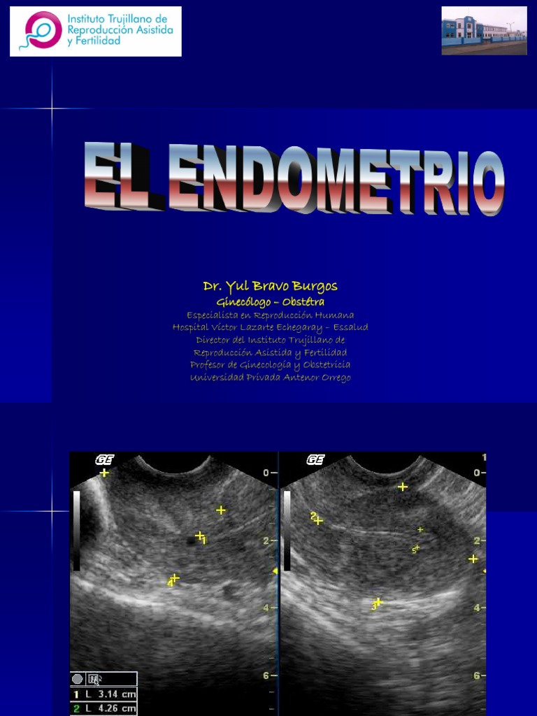 ECOGRAFÍA DEL ENDOMETRIO | PDF | Útero | Ultrasonido médico