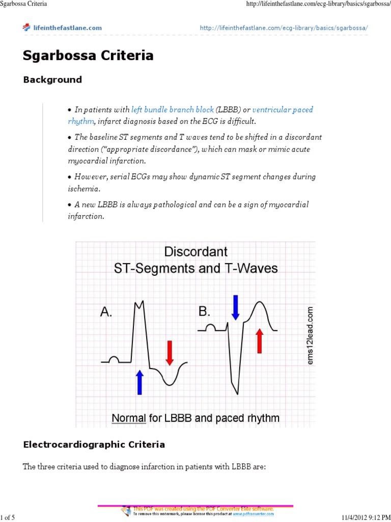 Sgarbossa Criteria | Electrocardiography | Myocardial Infarction