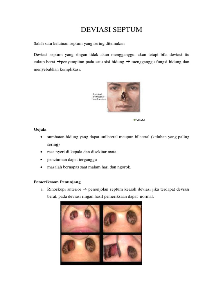 Deviasi Septum | PDF | Sains & Matematika