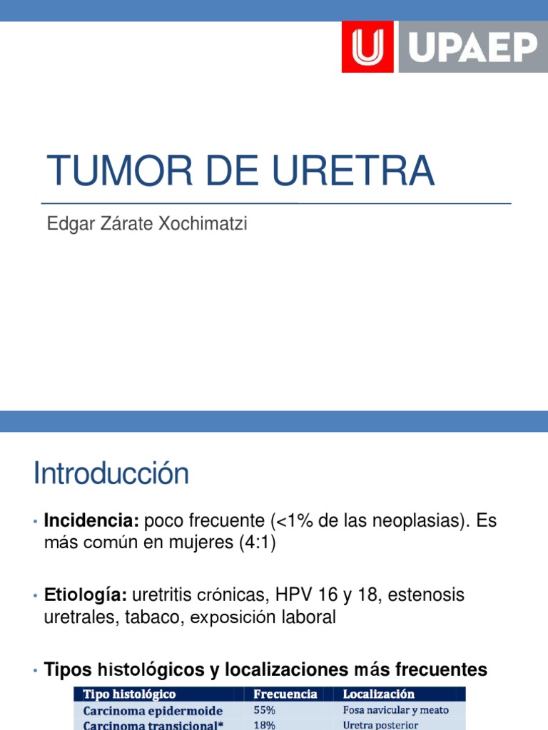 Tumor de Uretra: Diagnóstico y Tratamiento | PDF | Metástasis | Cáncer