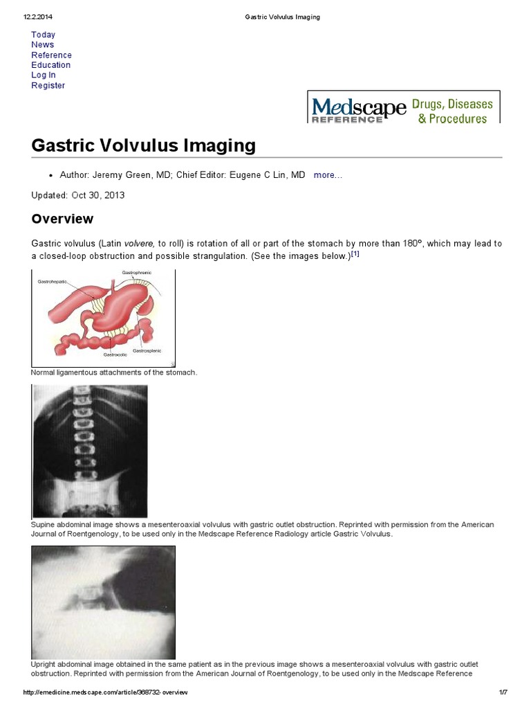 Gastric Volvulus Imaging | PDF | Radiology | Medical Imaging