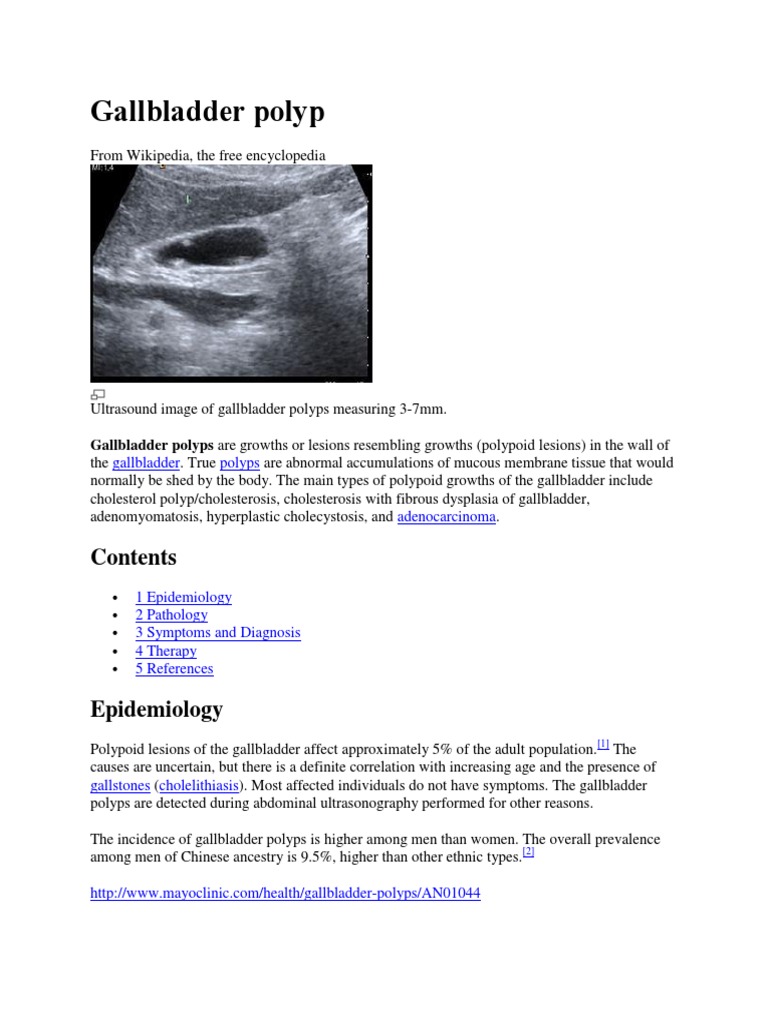 Gallbladder Polyp | PDF | Adenoma | Gallbladder