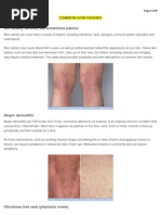 Steroid Emollient Ladders | PDF | Topical Medication | Medical Treatments