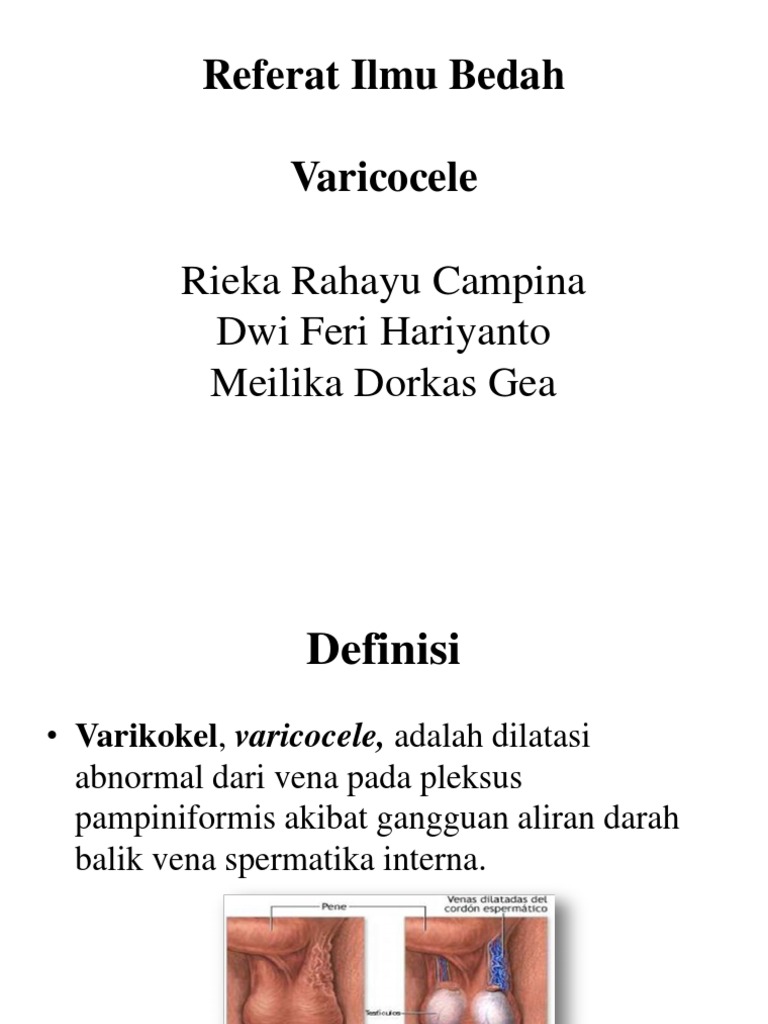 REFERAT BEDAH Varikokel | PDF