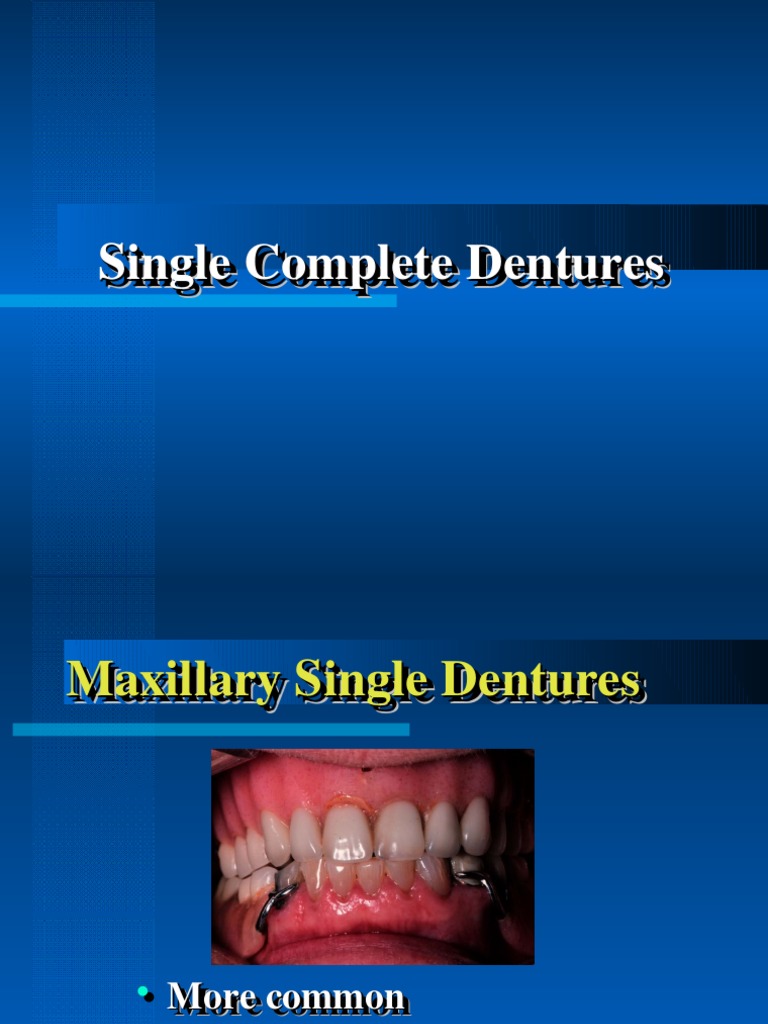 Single Complete Denture | PDF | Dentures | Dentistry Branches