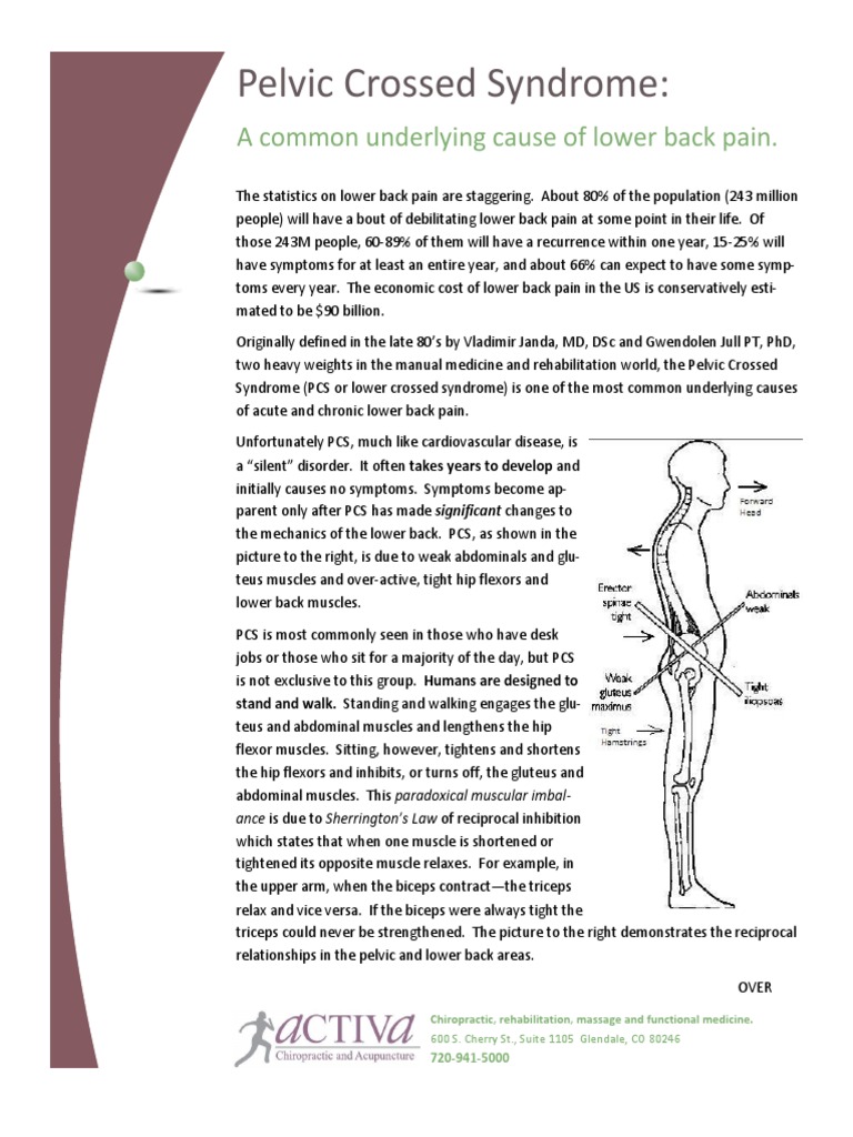 Pelvic Crossed Syndrome | PDF | Pelvis | Chiropractic