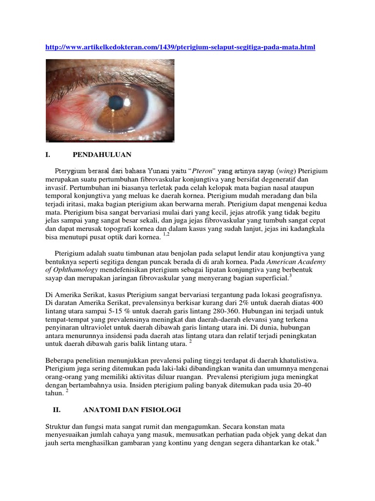 Pterygium | PDF