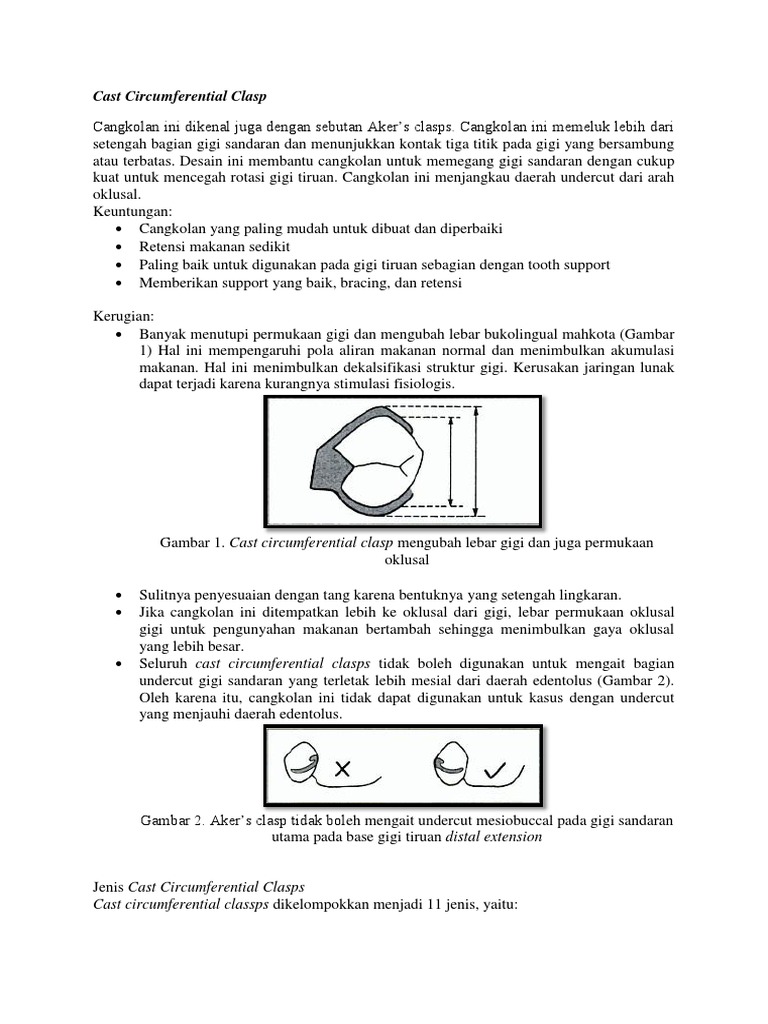 Cast Circumferential Clasp | PDF