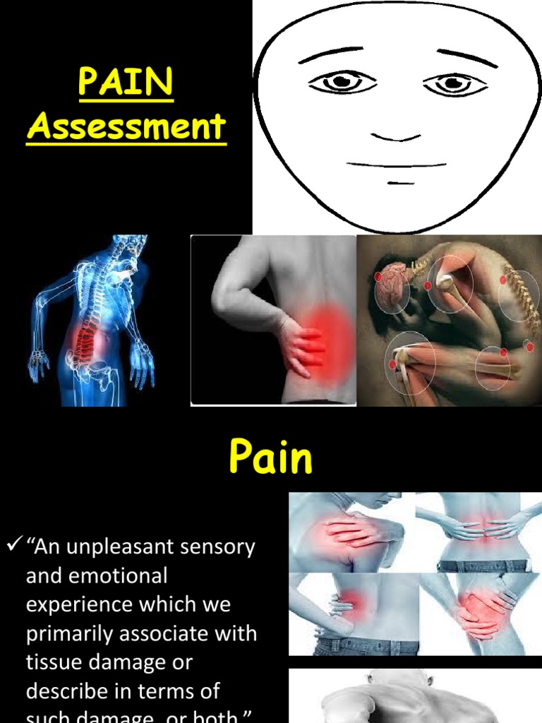 Pain | PDF | Pain | Stimulus (Physiology)