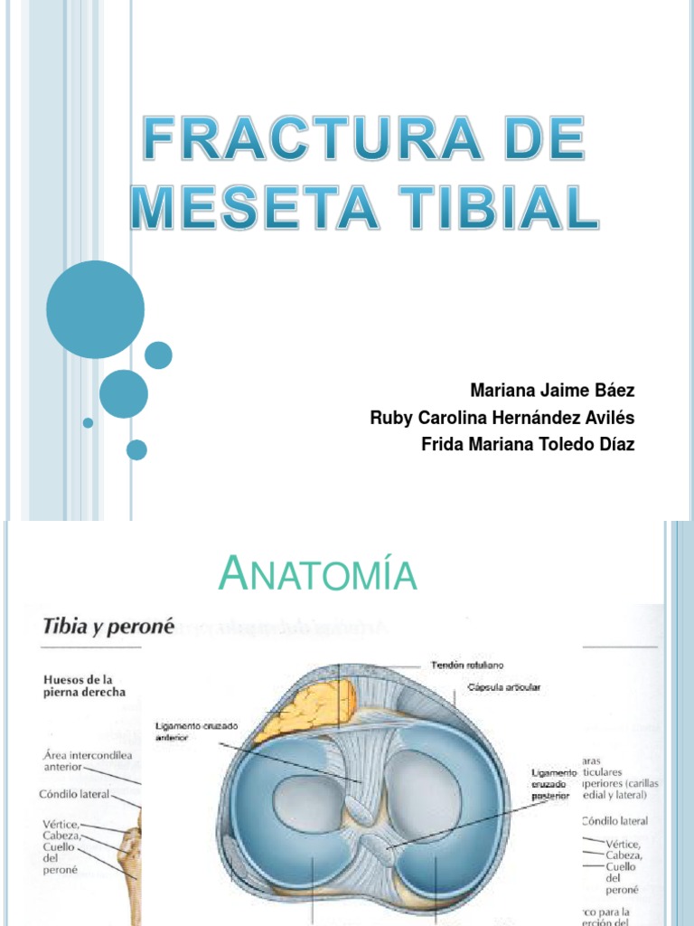 Fractura de Meseta Tibial | PDF | Rodilla | Sistema musculoesquelético