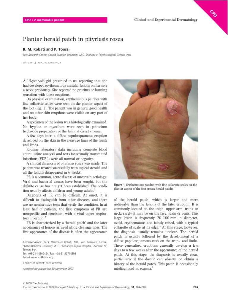 Plantar Herald Patch in Pityriasis Rosea | Cutaneous Conditions ...