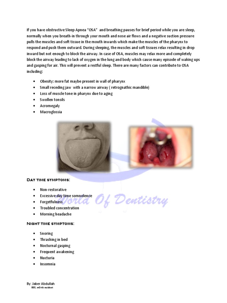 Obstructive Sleep Apnea An Orthodontic Approach Pdf Sleep Apnea
