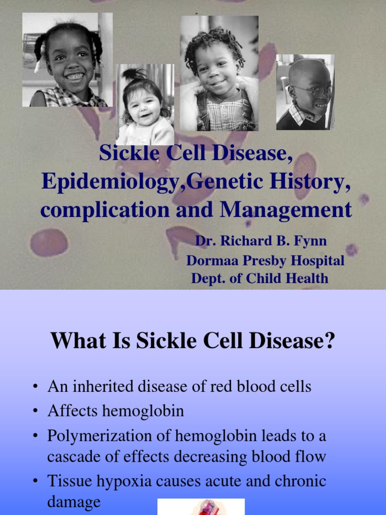 Sickle Cell Disease, Epidemiology, Genetic History, Complication and ...