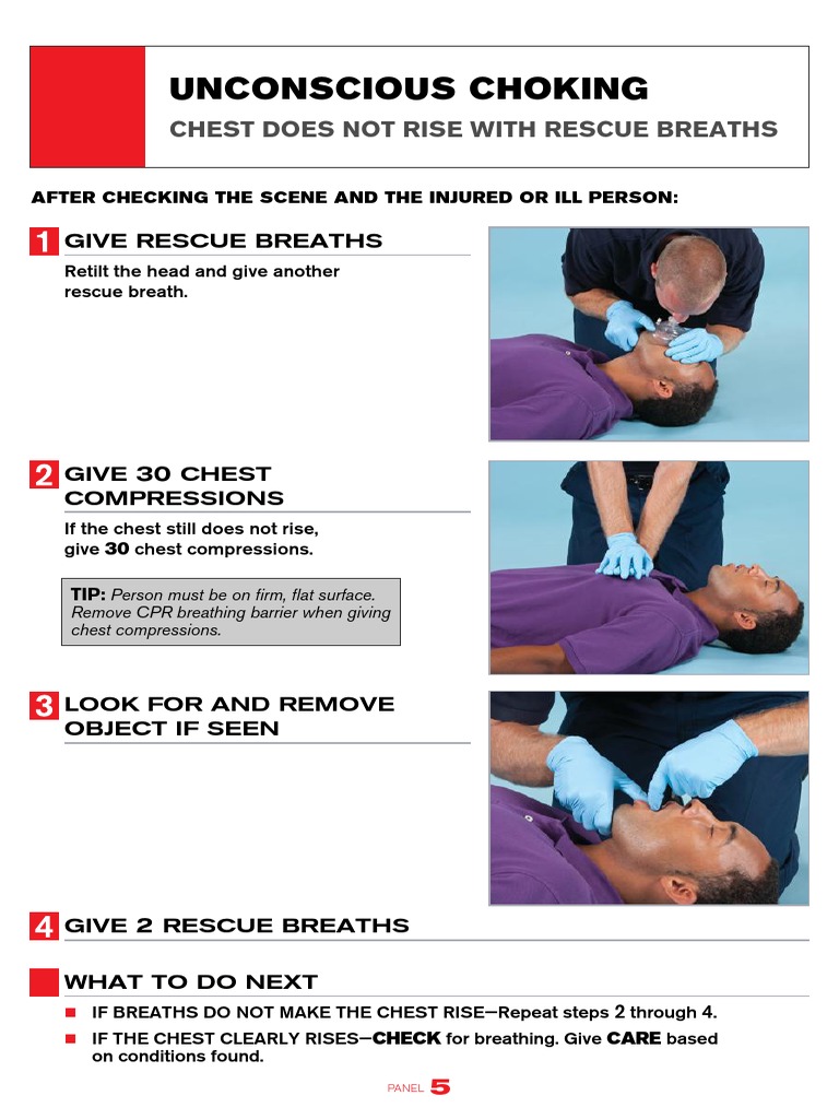 Unconscious Choking CPR Steps | PDF