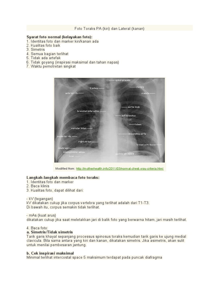 Foto Toraks PA | PDF
