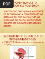 Pasos Quirúrgicos para La Cesárea Tipo Kerr | PDF | Abdomen | Seccion ...