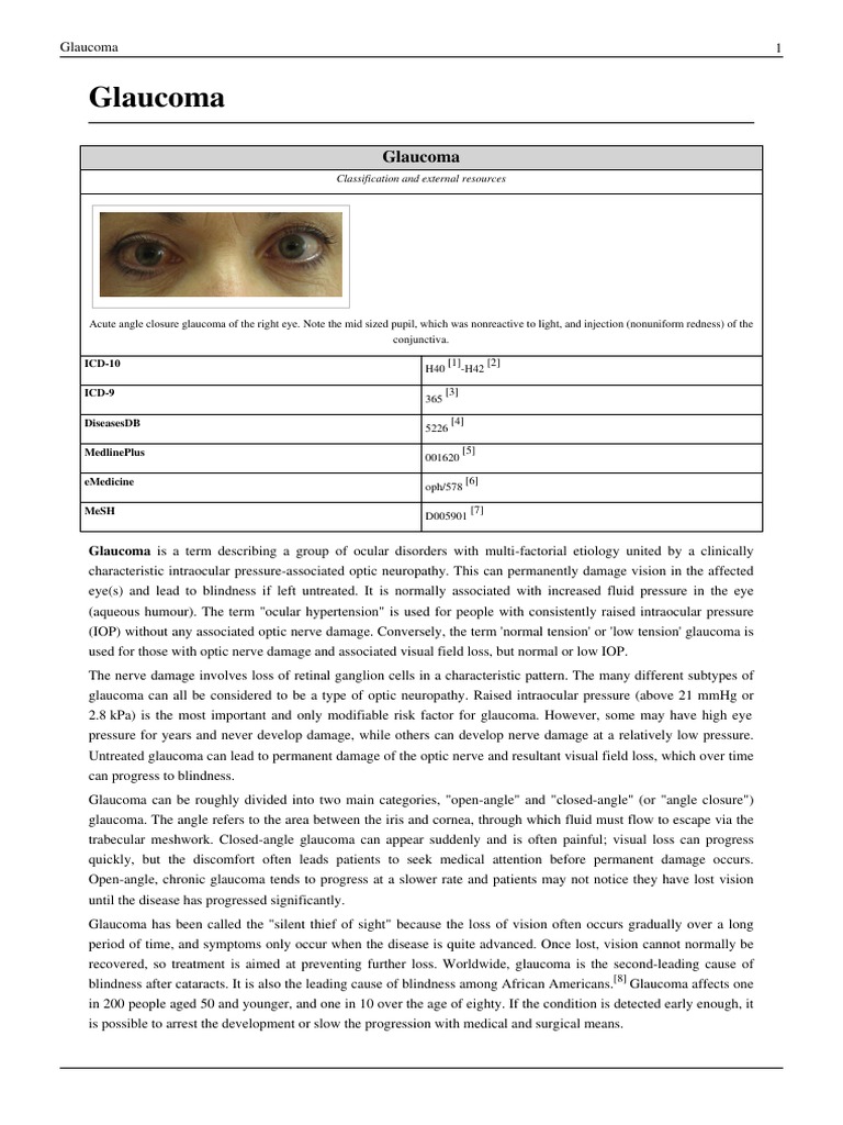 Glaucoma | PDF | Glaucoma | Ophthalmology