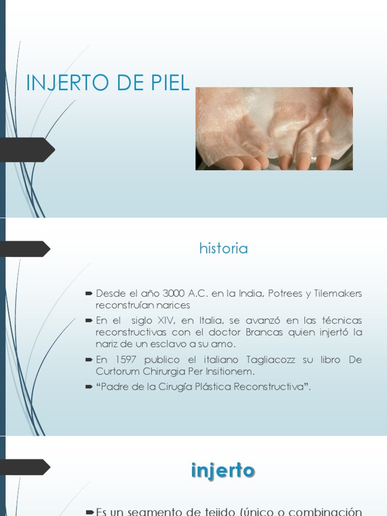 Injerto de Piel | Piel | Herida
