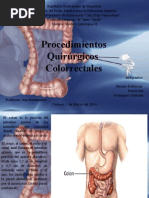 Sigmoidectomía Laparoscópica: Técnica y Equipo | PDF | Intestino grueso ...