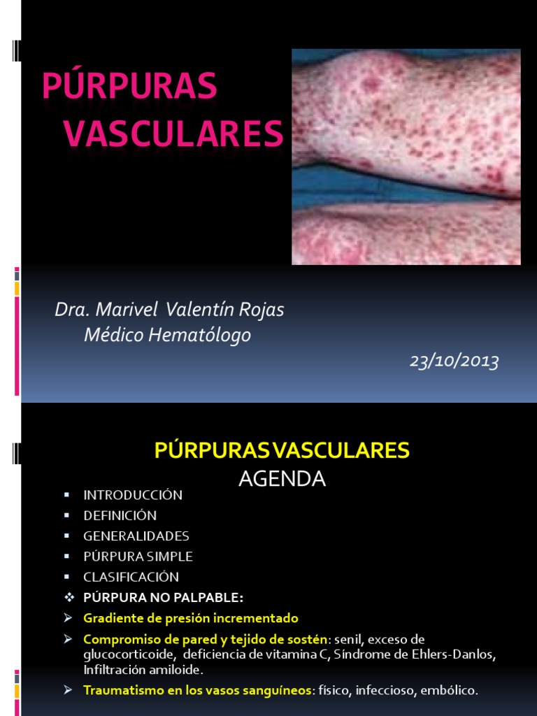 12AVA CLASE - 23.10.13 - PÚRPURAS VASCULARES - HMA | Especialidades ...