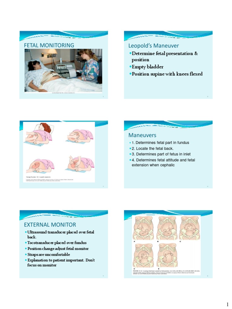 Fetal Monitoring | PDF | Health Sciences | Clinical Medicine